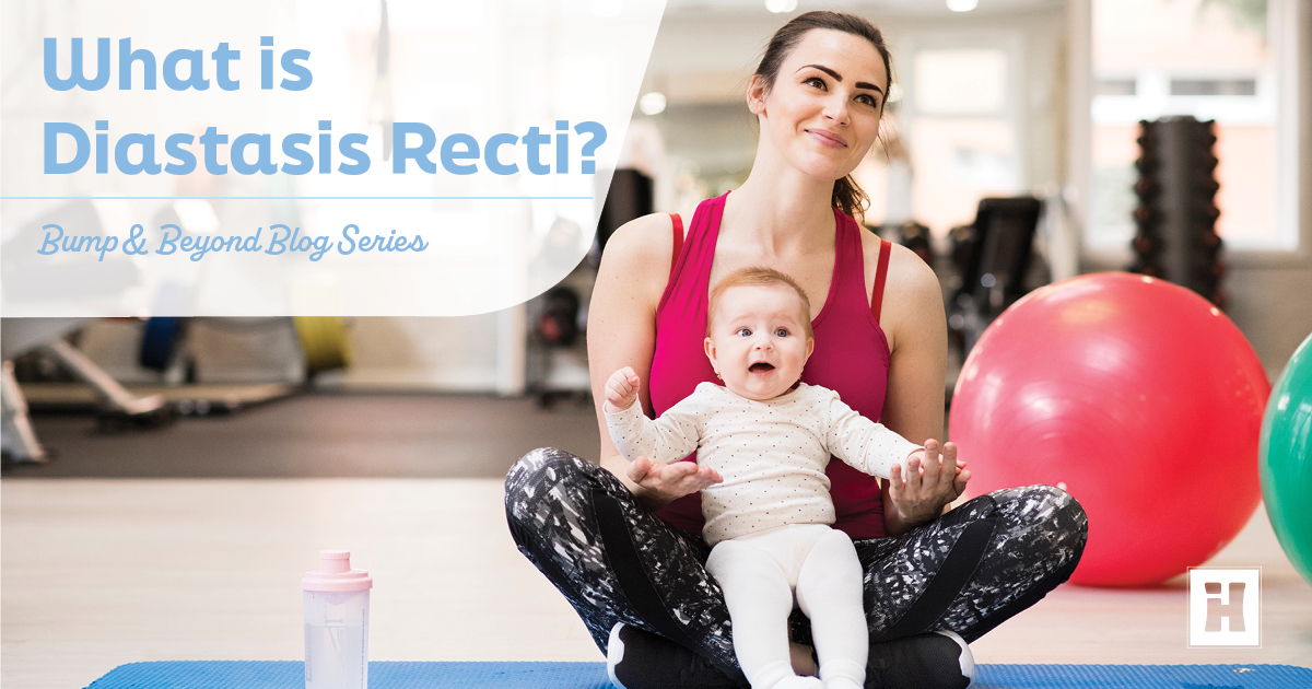 Bump & Beyond | Diastasis Recti
